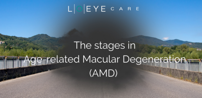 Three stages of Age-Related Macular Degeneration (AMD) - LO Eye Care
